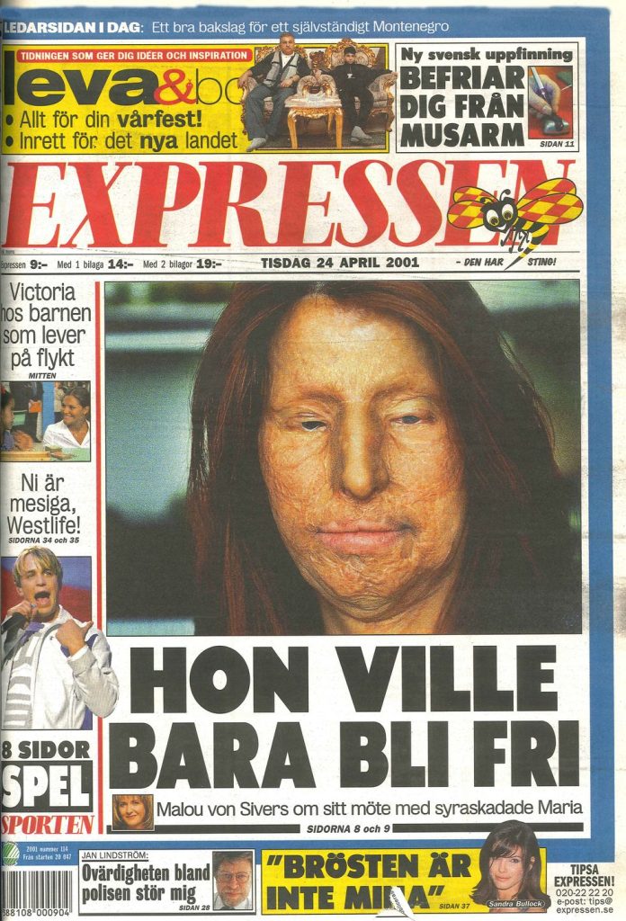 Maria Rashidi: “Mitt ansikte brann upp och rann av mig” - Icakuriren